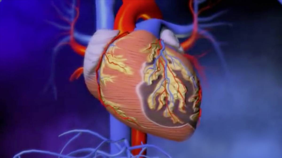 Con un TAC Coronario podrás saber si sufrirás un infarto en 5 años - AS.com