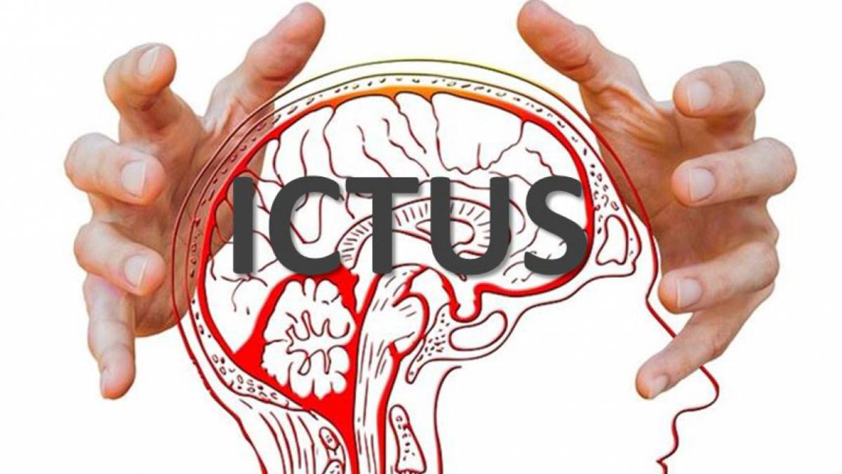 El ictus podría prevenirse en un 80% de los casos - AS.com