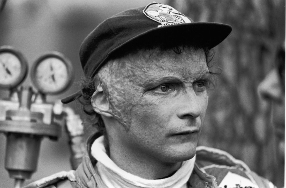 F1 | "Lauda, en peligro de muerte" - AS.com